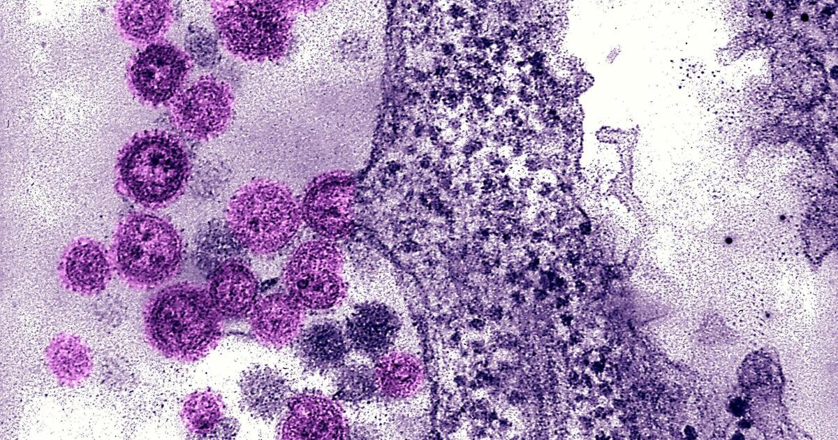 Wo kommt das Machupo-Virus vor? | GMX